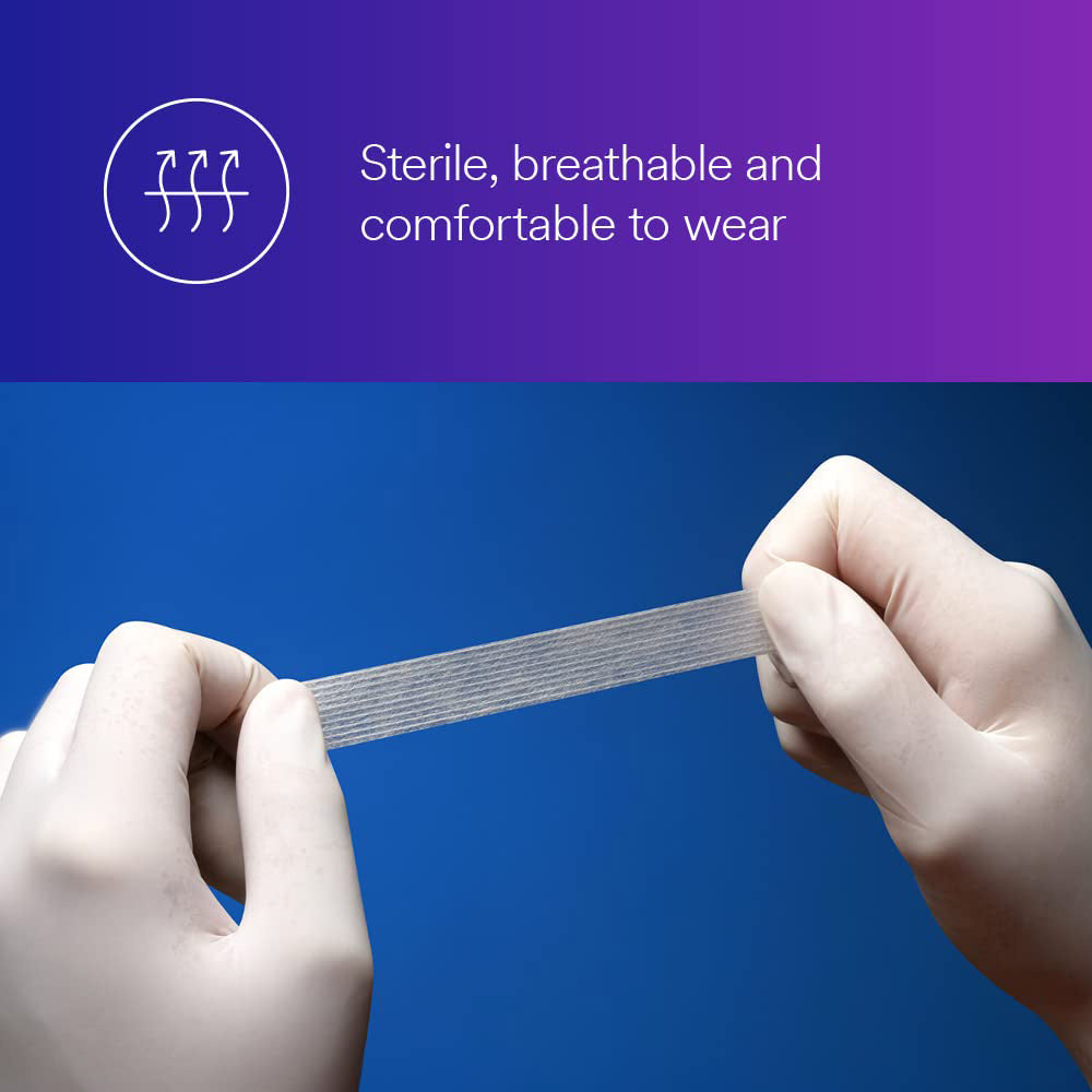 3M Steri-Strip Adhesive Skin Closures, R1541 | United Canada Inc.